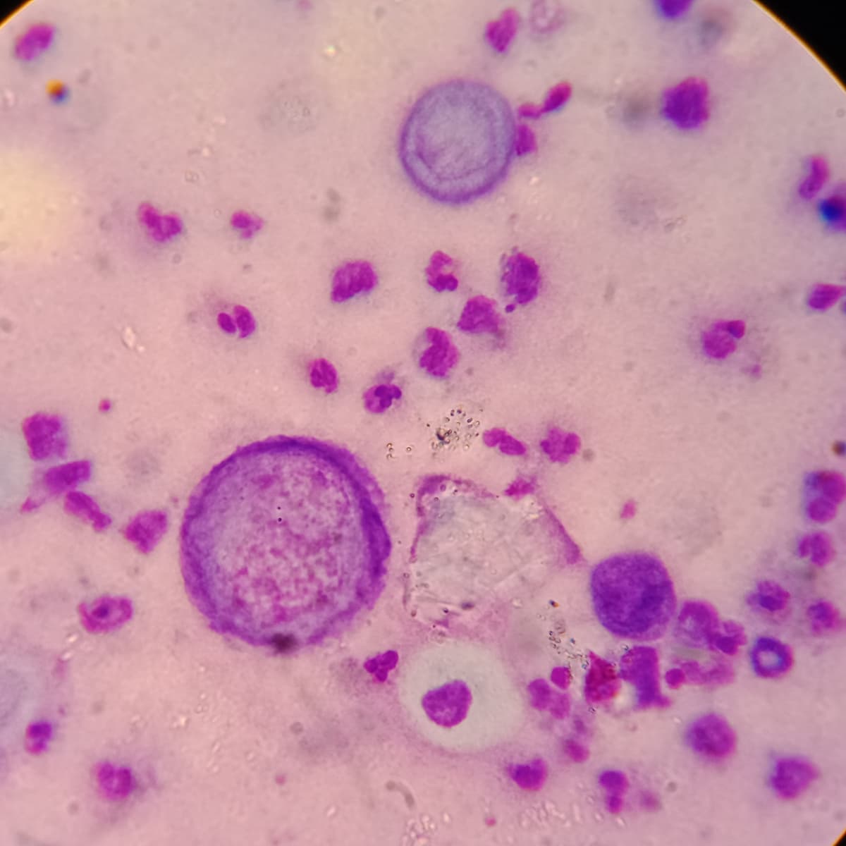 Herpes Simplex Virus 1 And 2 Eradication Scalar Light